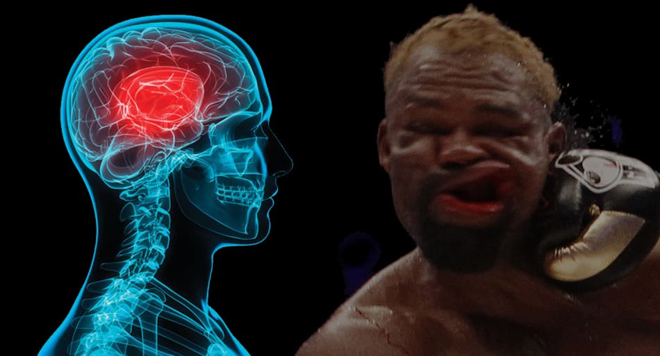 Study finds lack of brain injury risk knowledge by many MMA participants