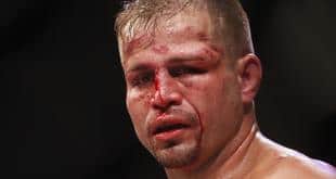 Maldonado: I fight better when I’m tired and bleeding